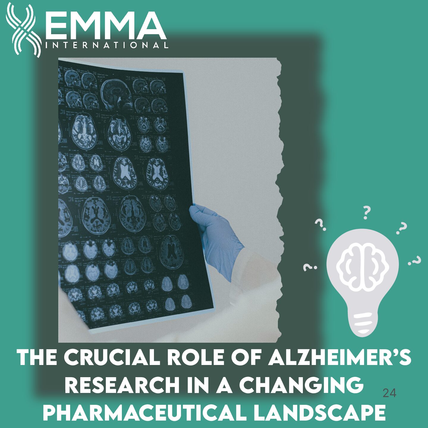 Alzheimer s Research